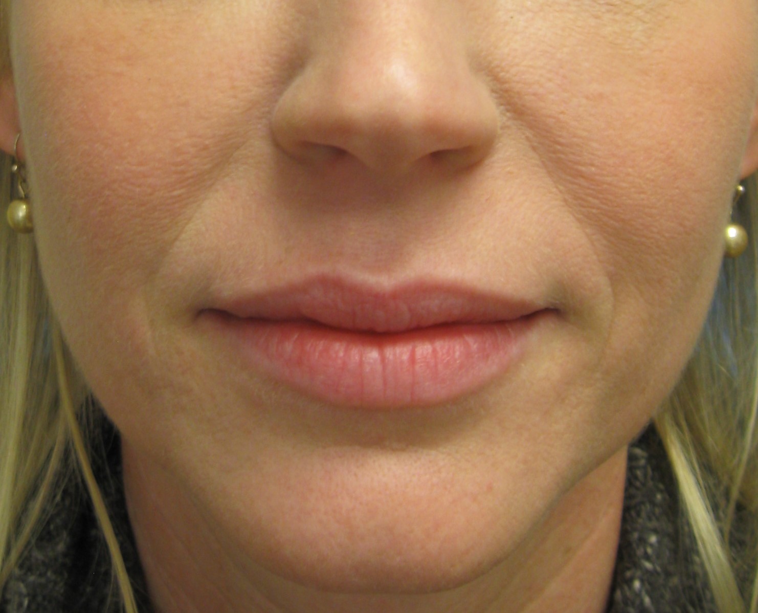 Volbella - Cobb Wellness and Aesthetics